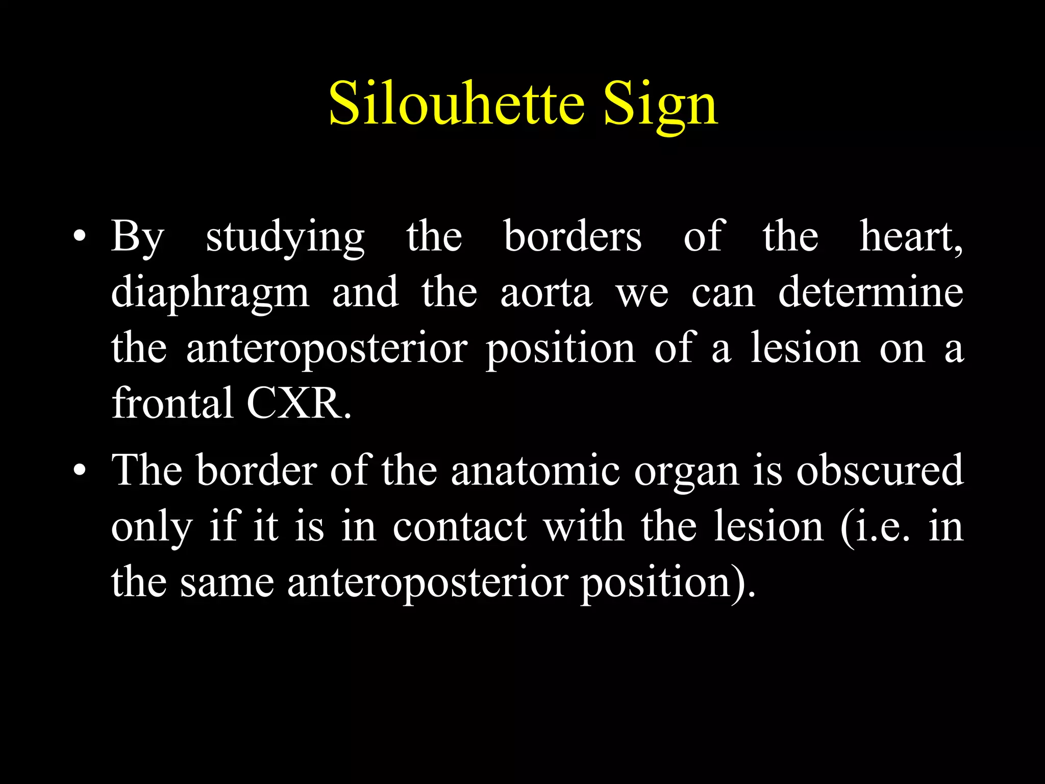 Helpful radiological signs in cxr25 11-91 | PPTX