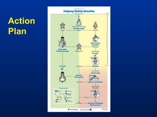 Helping Babies Breathe | PPT