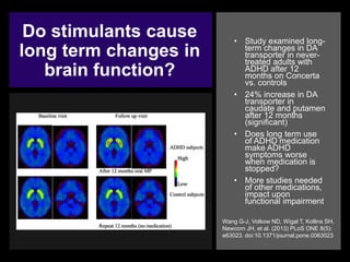 Helping Patients Through ADHD Medication Shortages and Discontinuation ...