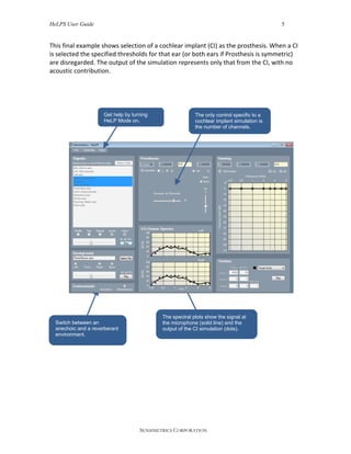 Hearing Loss and Prosthesis Simulator | PDF