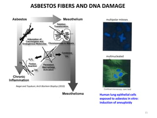 Asbestos-related diseases - mechanisms and causation at Helsinki ...