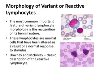 Reactive Lymphocytes