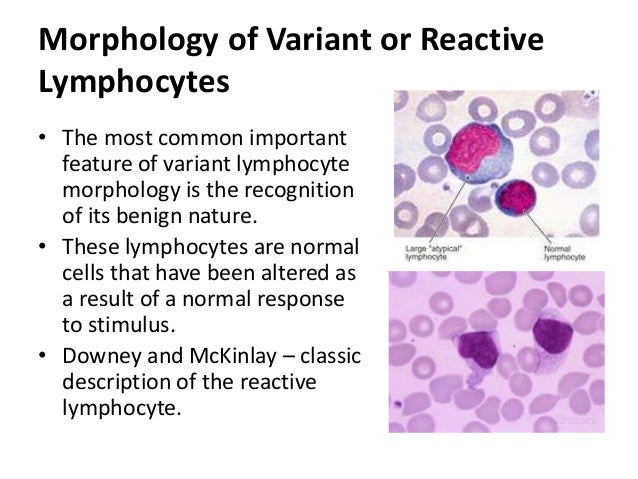NON-MALIGNANT REACTIVE DISORDERS OF LYMPHOCYTES
