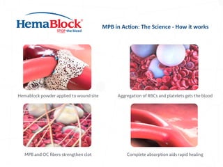 Hemablock - How it works | PPT