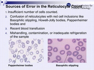 Hema I Chapter 13_Retics.ppt