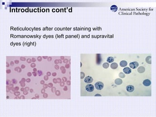 Hema I Chapter 13_Retics.ppt