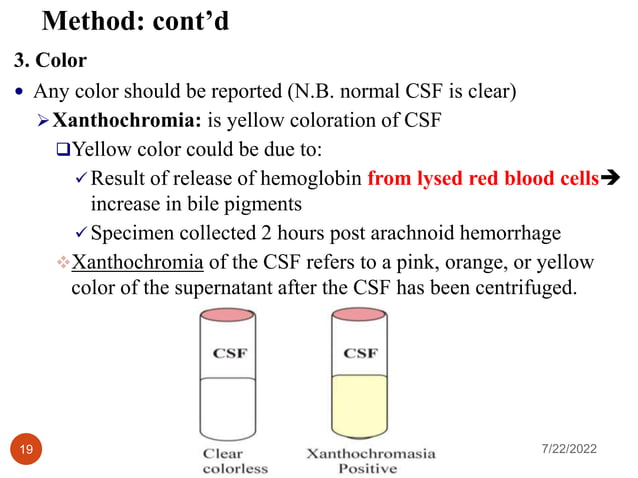 Hema I Chapter 14 CSF.ppt