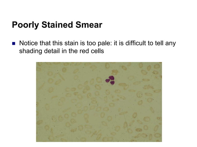 Hema I Chapter 6_staining.ppt | Chemistry | Science