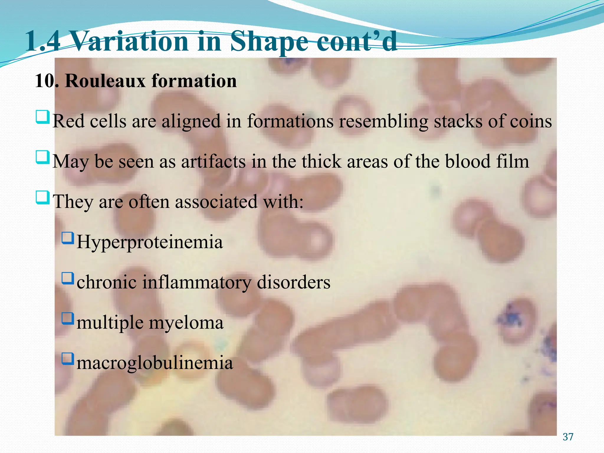 Hema II Chapter 1_RBC morphology study.pptx