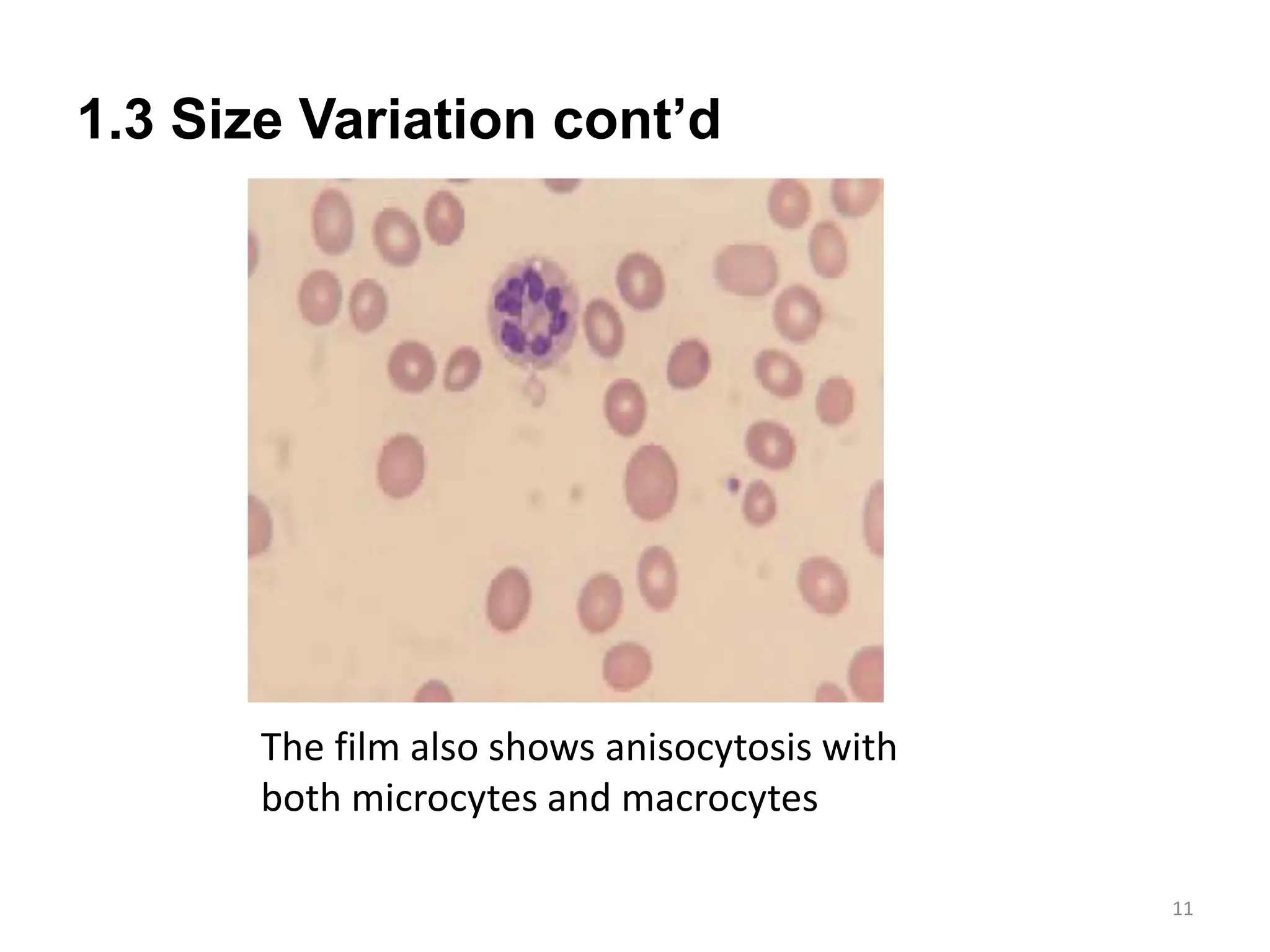 Hema II Chapter 2_RBC morphology study_AT.ppt