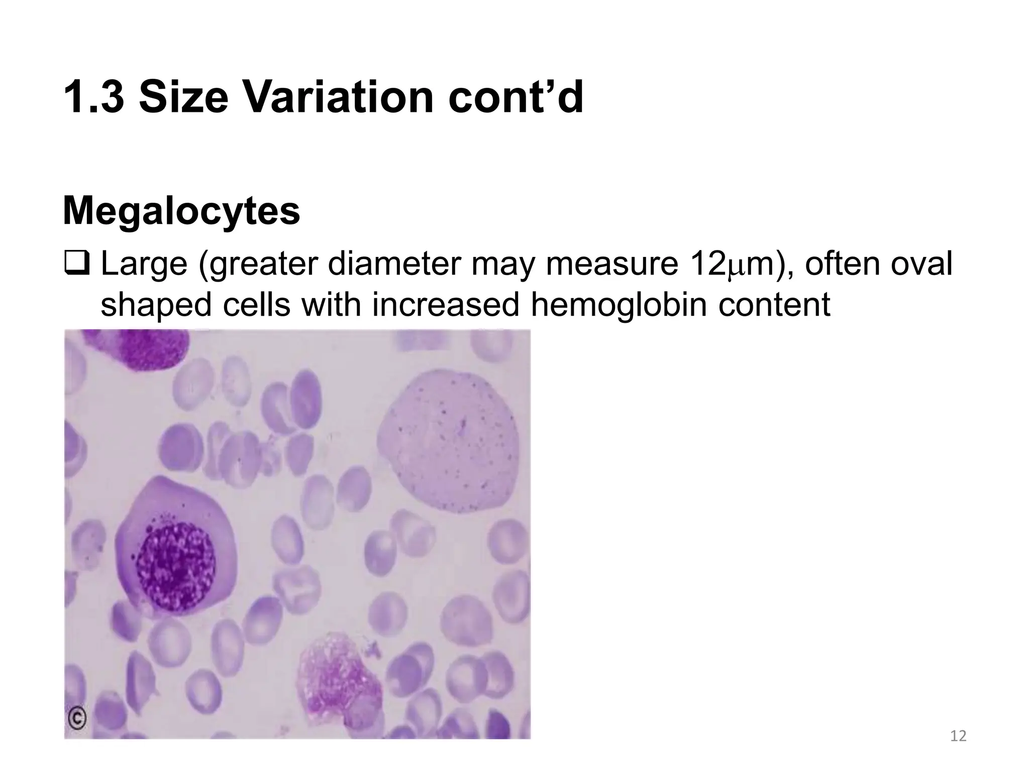 Hema II Chapter 2_RBC morphology study_AT.ppt