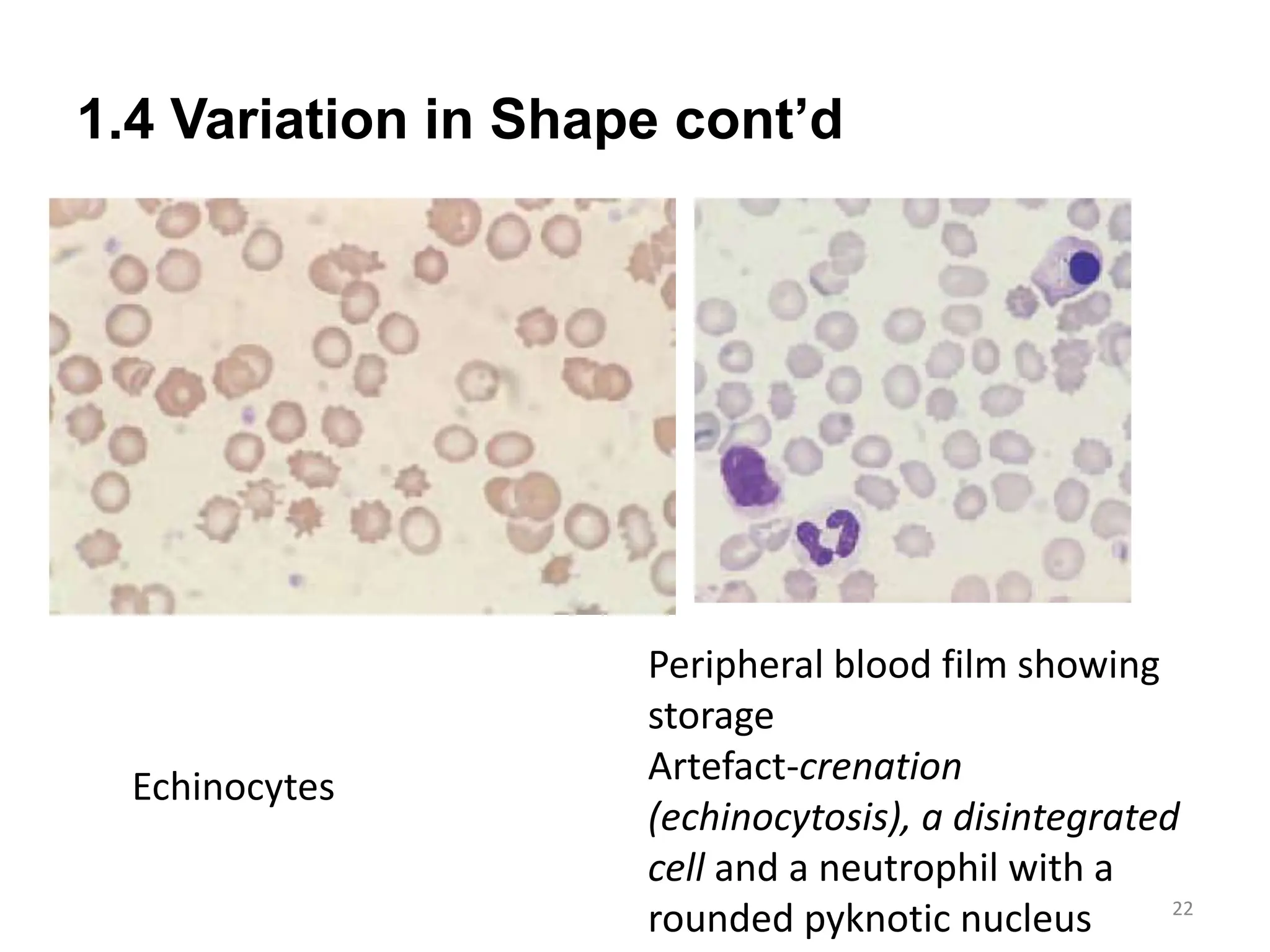 Hema II Chapter 2_RBC morphology study_AT.ppt
