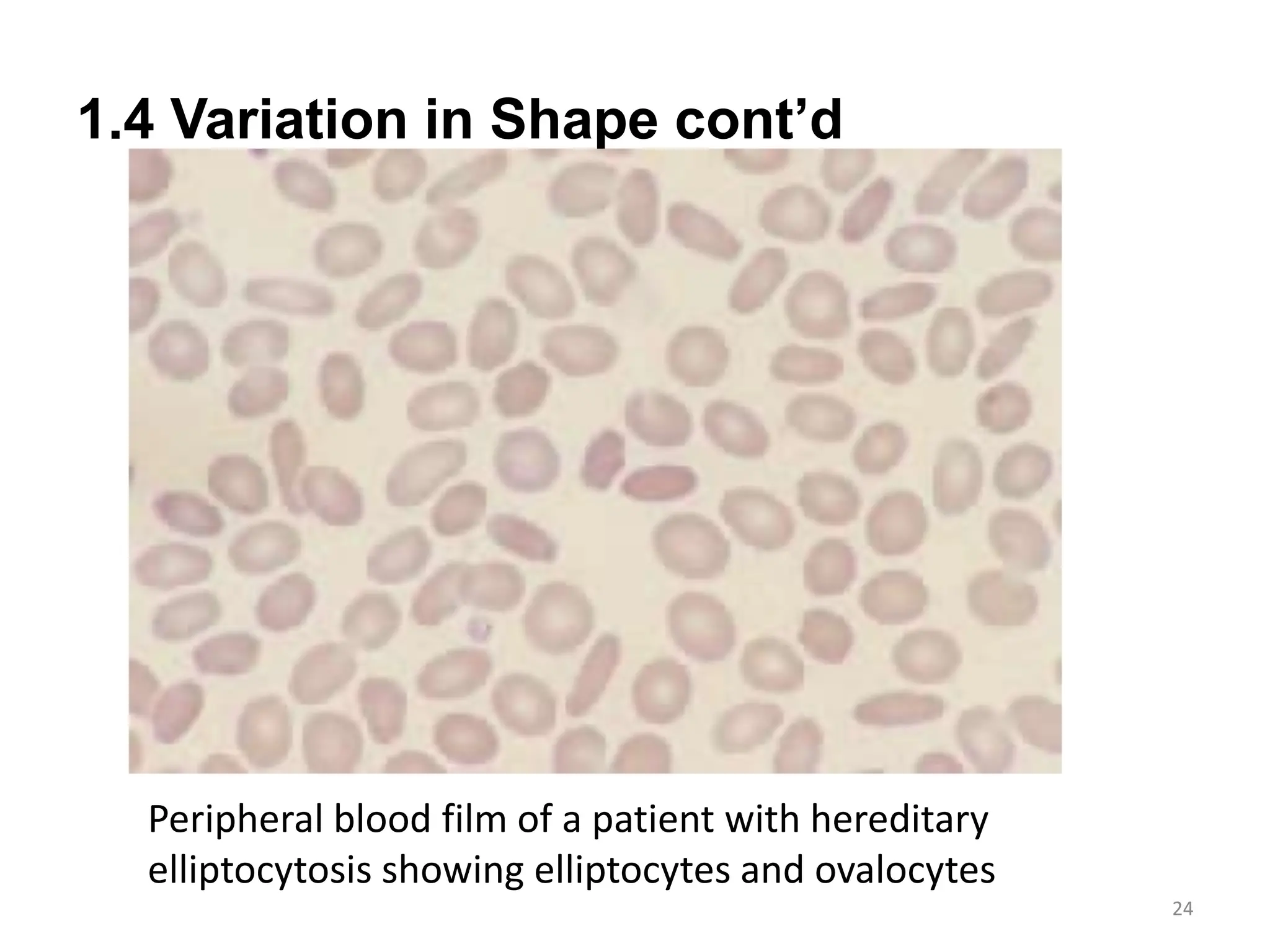 Hema II Chapter 2_RBC morphology study_AT.ppt