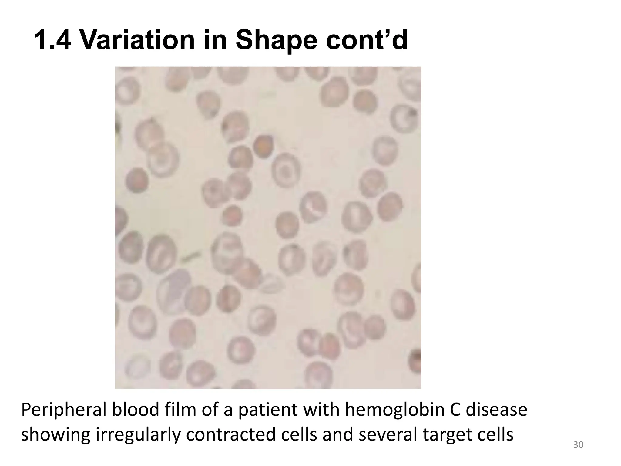 Hema II Chapter 2_RBC morphology study_AT.ppt