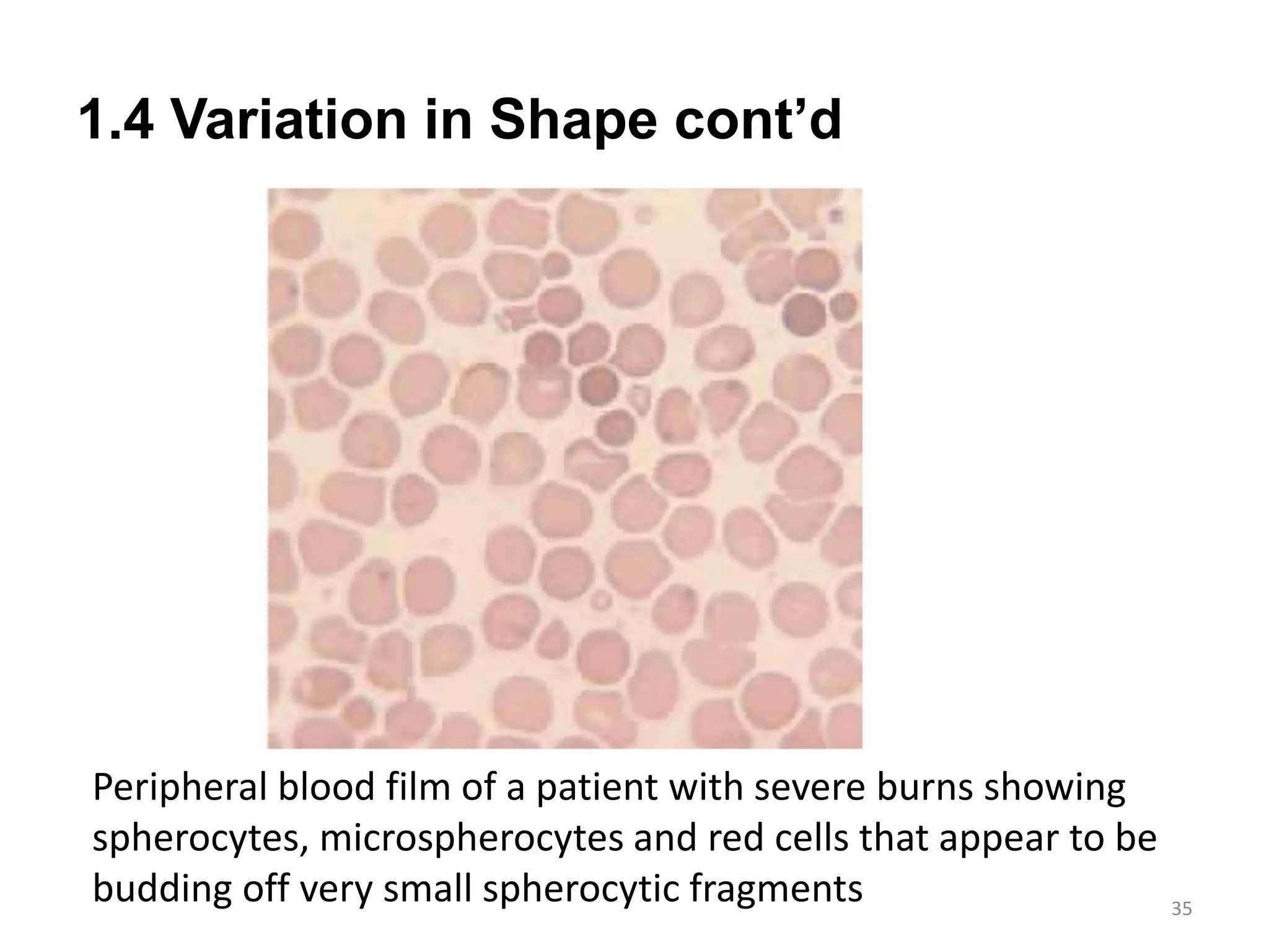 Hema II Chapter 2_RBC morphology study_AT.ppt