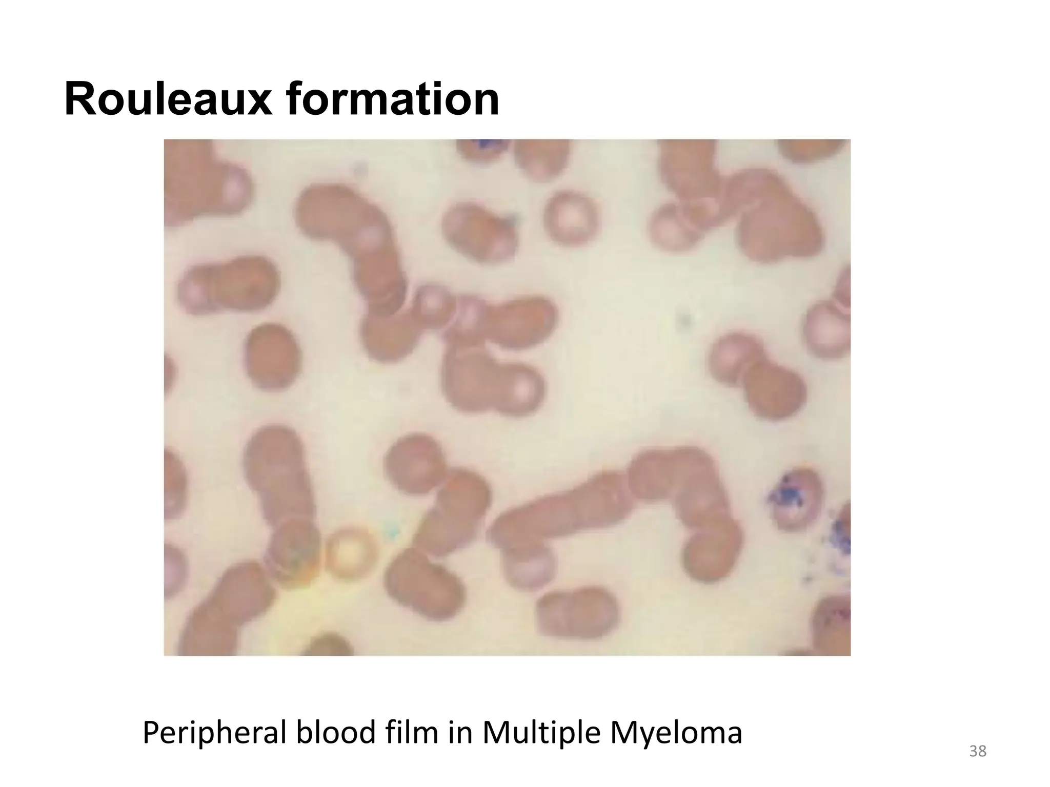Hema II Chapter 2_RBC morphology study_AT.ppt