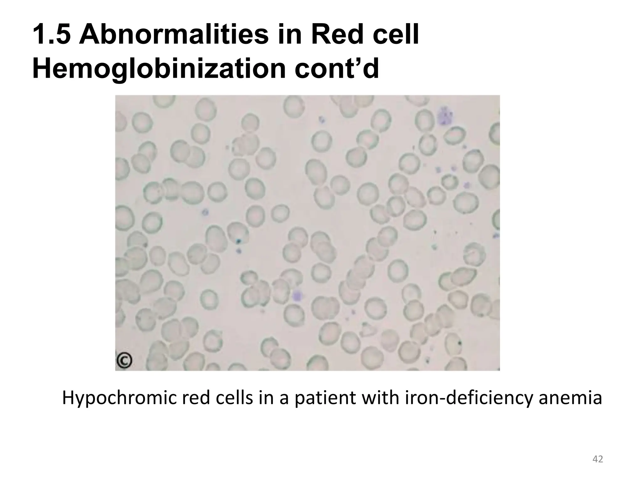 Hema II Chapter 2_RBC morphology study_AT.ppt