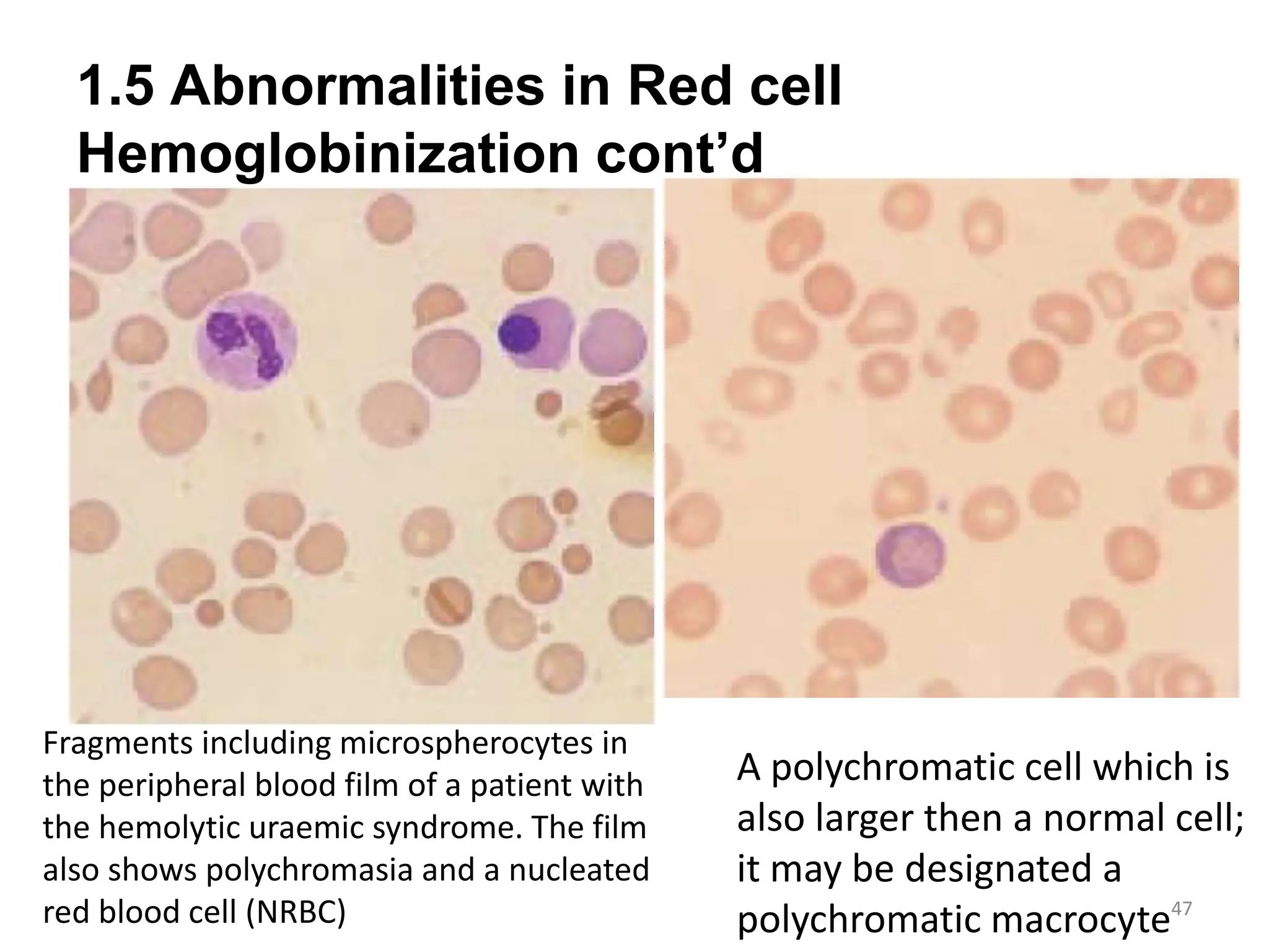 Hema II Chapter 2_RBC morphology study_AT.ppt