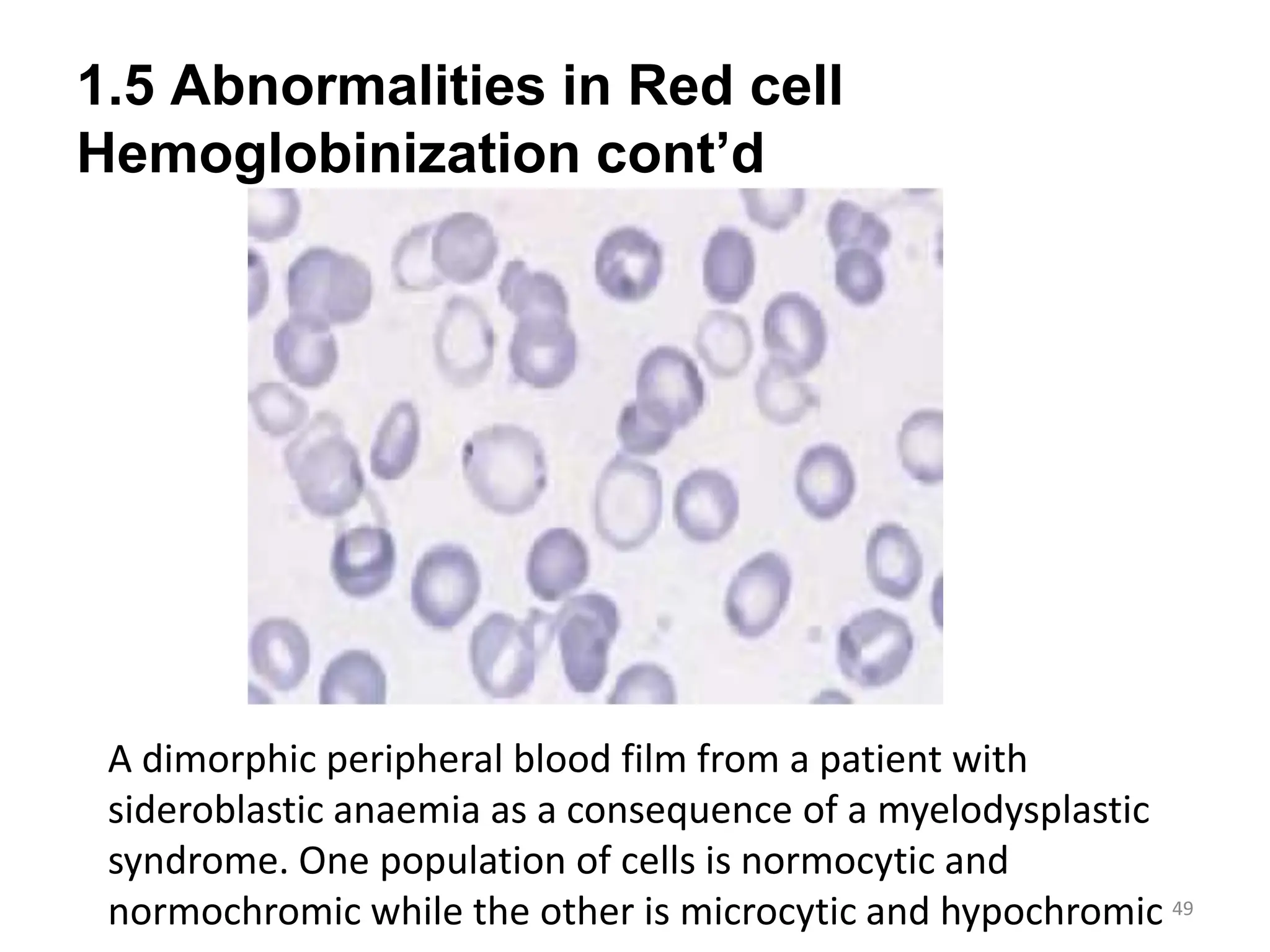 Hema II Chapter 2_RBC morphology study_AT.ppt