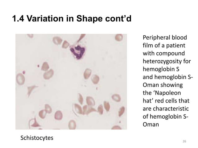 Hema II Chapter 2_RBC morphology study_AT.ppt