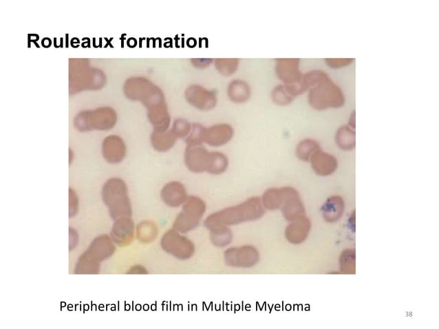 Hema II Chapter 2_RBC morphology study_AT.ppt