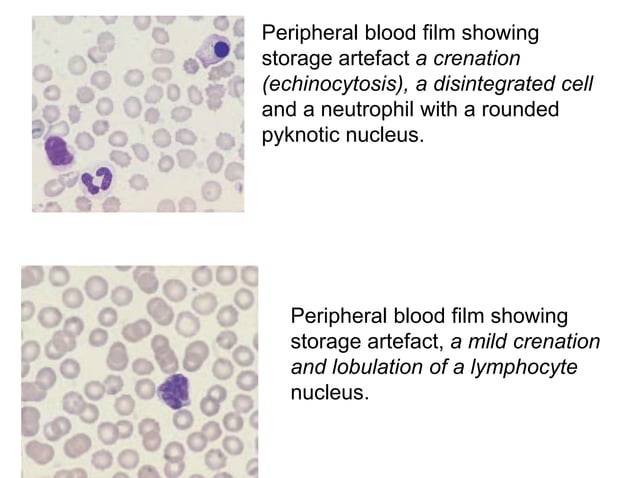Hema II Chapter 2_RBC morphology study_AT.ppt