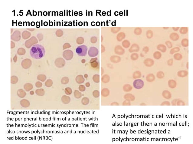 Hema II Chapter 2_RBC morphology study_AT.ppt