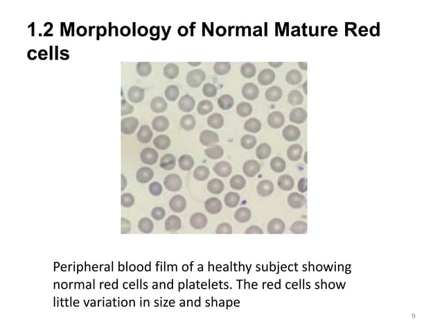 Hema II Chapter 2_RBC morphology study_AT.ppt