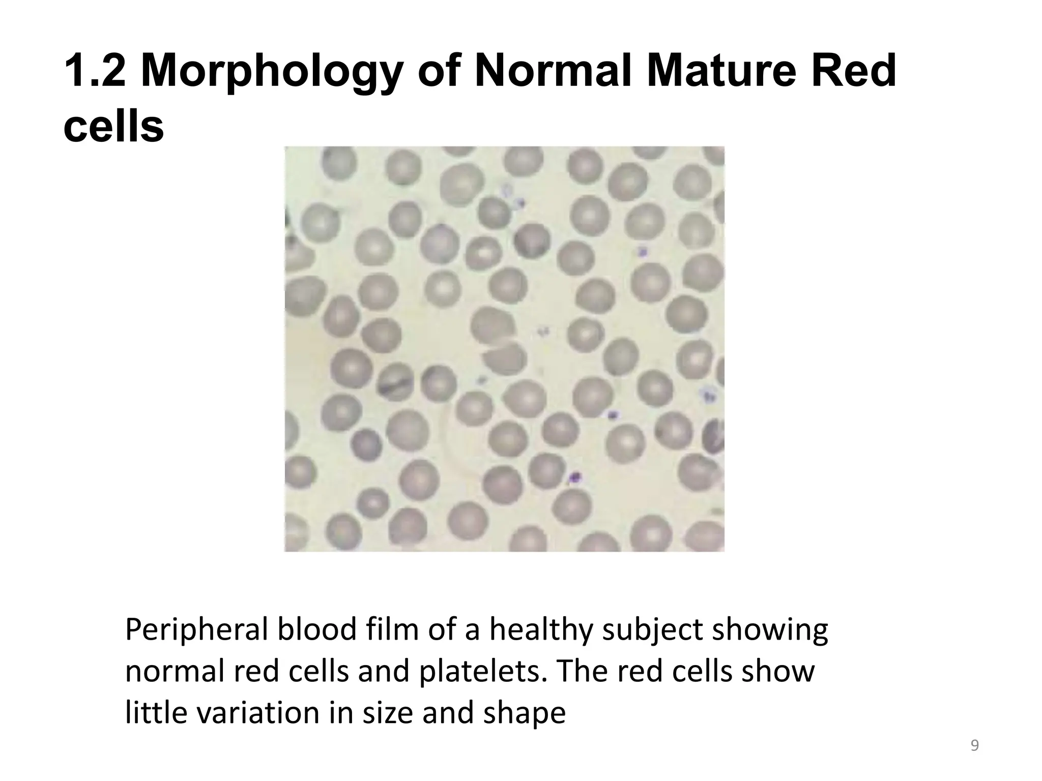 Hema II Chapter 2_RBC morphology study_AT.ppt
