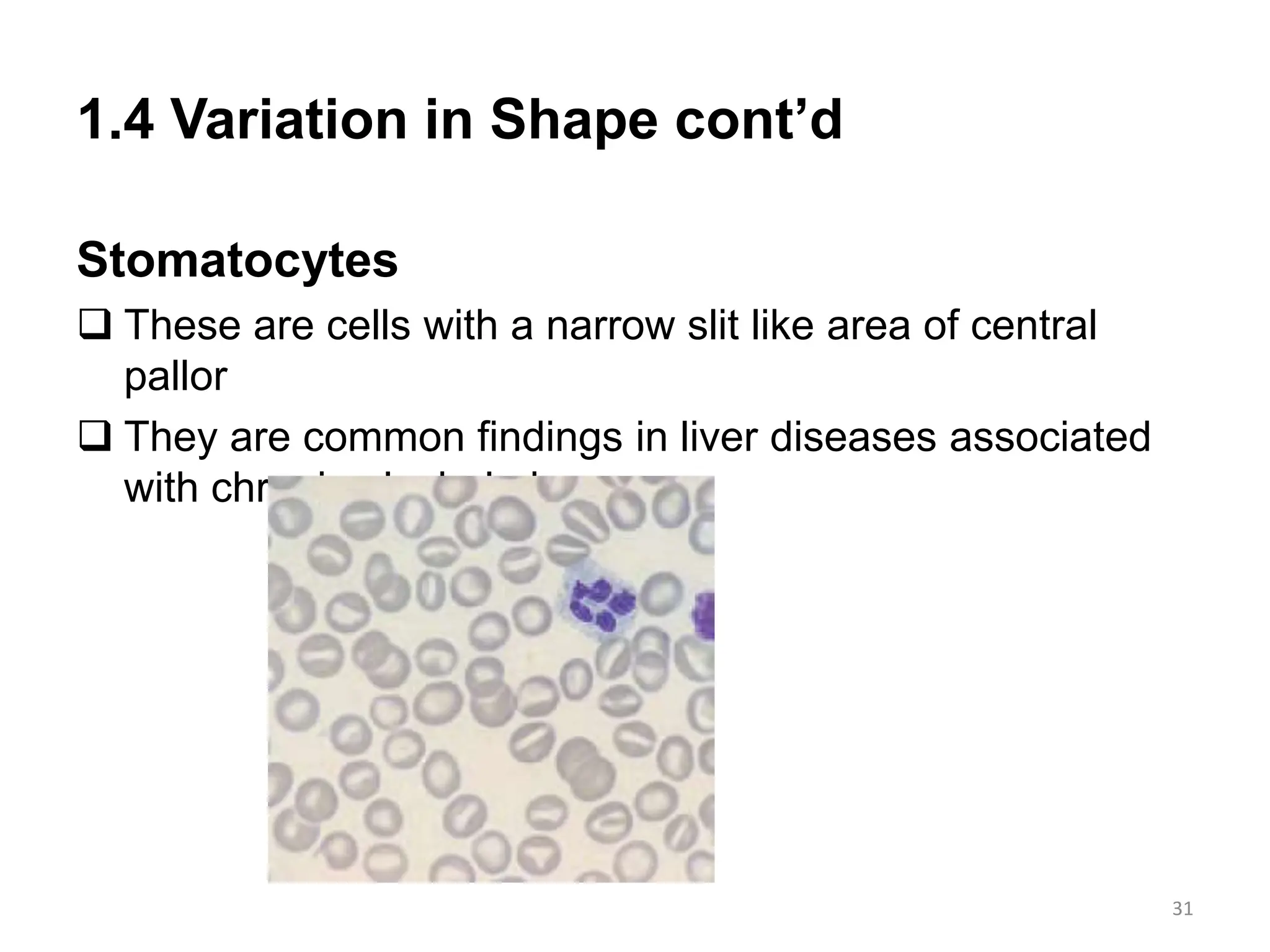 Hema II Chapter 2_RBC morphology study_AT.ppt