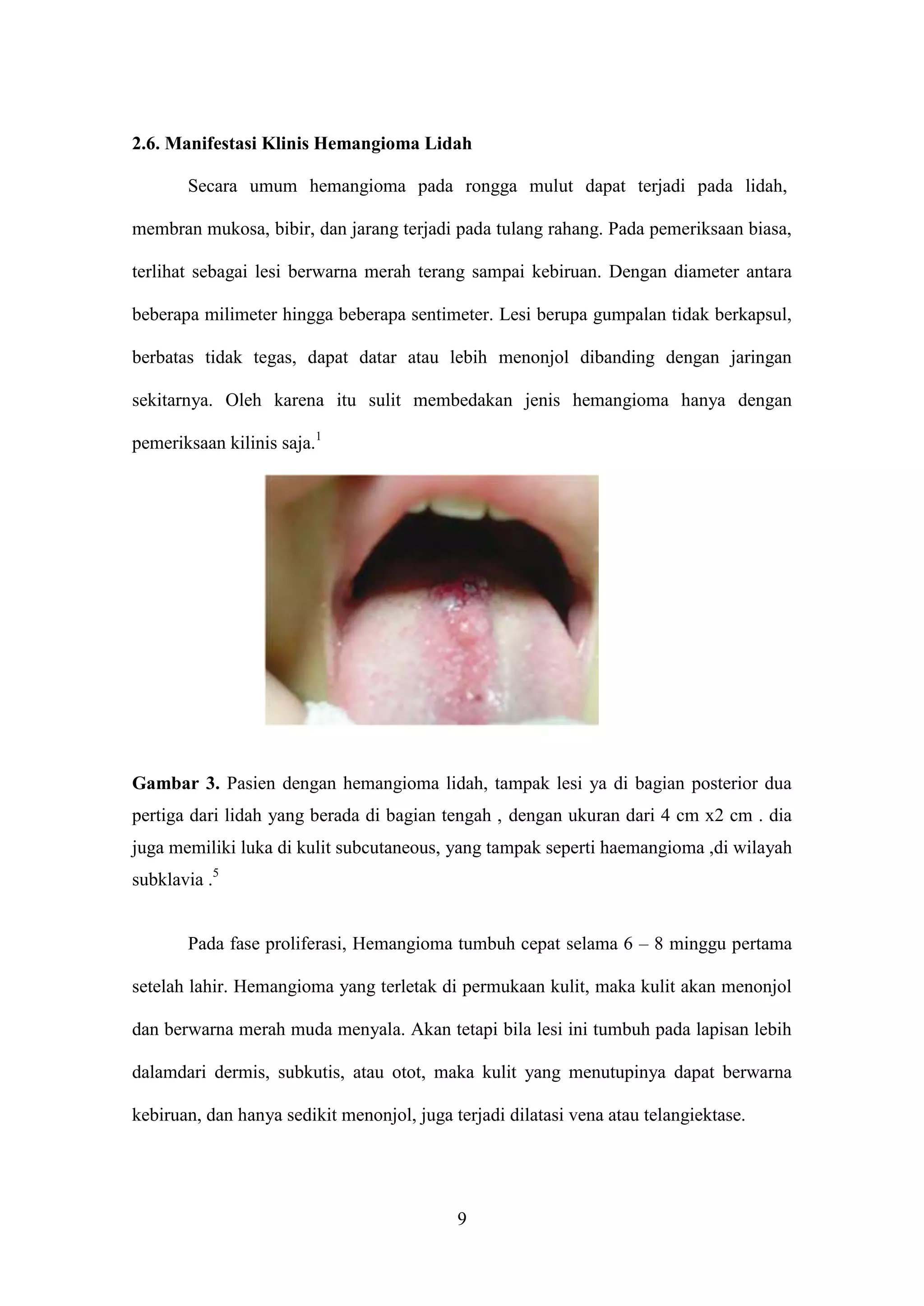 Hemangioma | DOCX