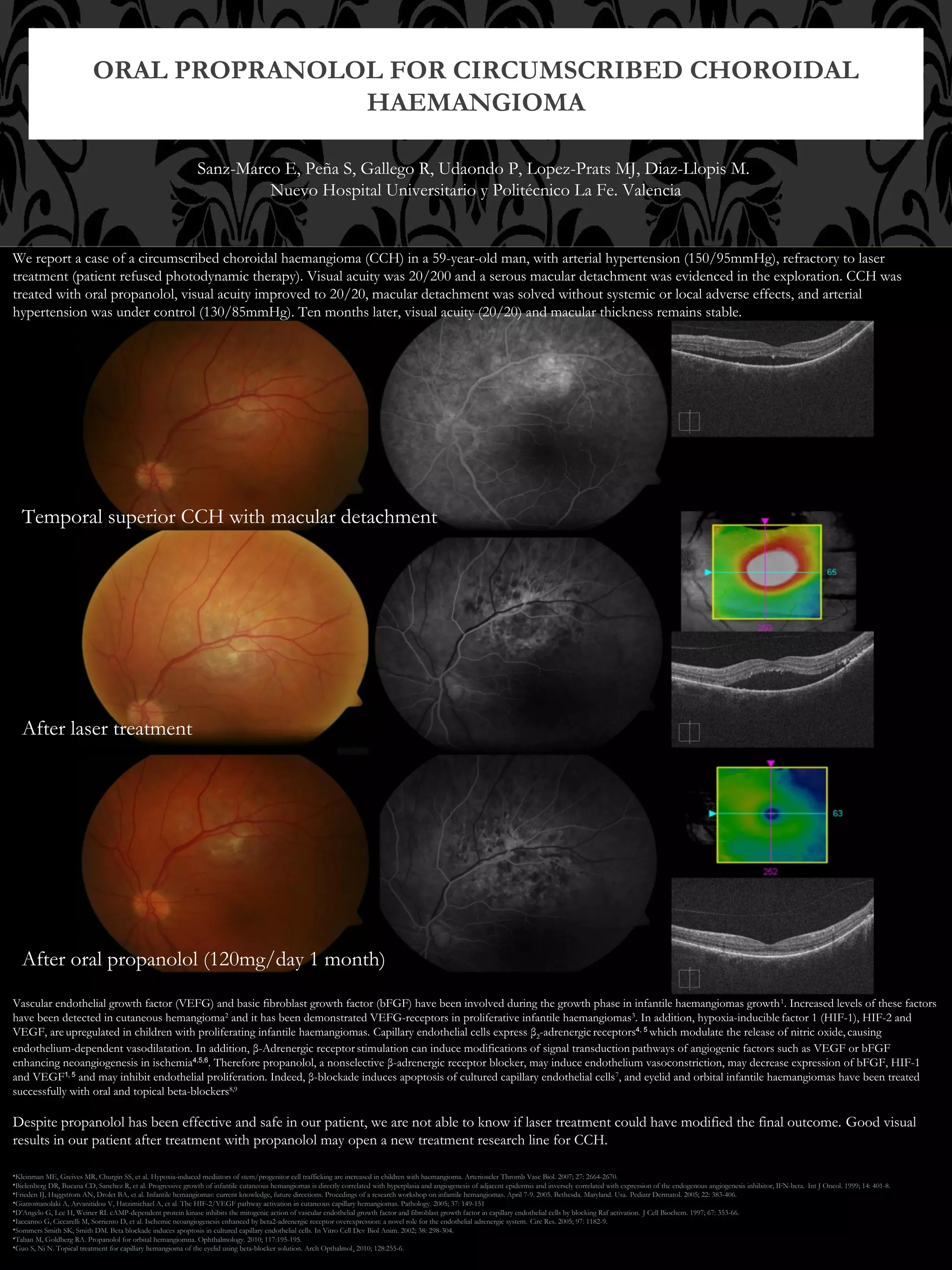 Choroidal haemangioma & propanolol | PPT