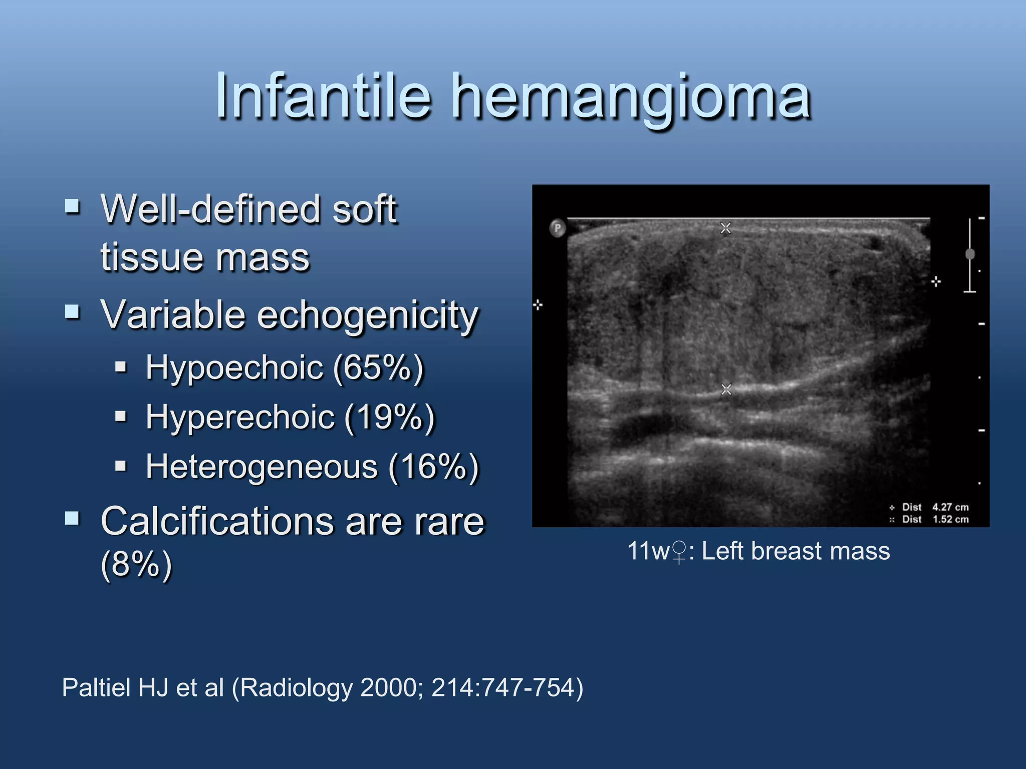 Ultrasound of Vascular anomalies by Oscar M. Navarro | PDF