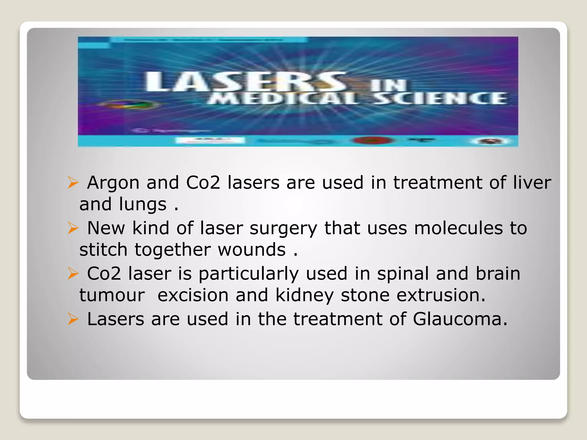 lasers ppt | PPTX