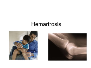 Hemartrosis | PPT