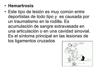 Hemartrosis | PPT