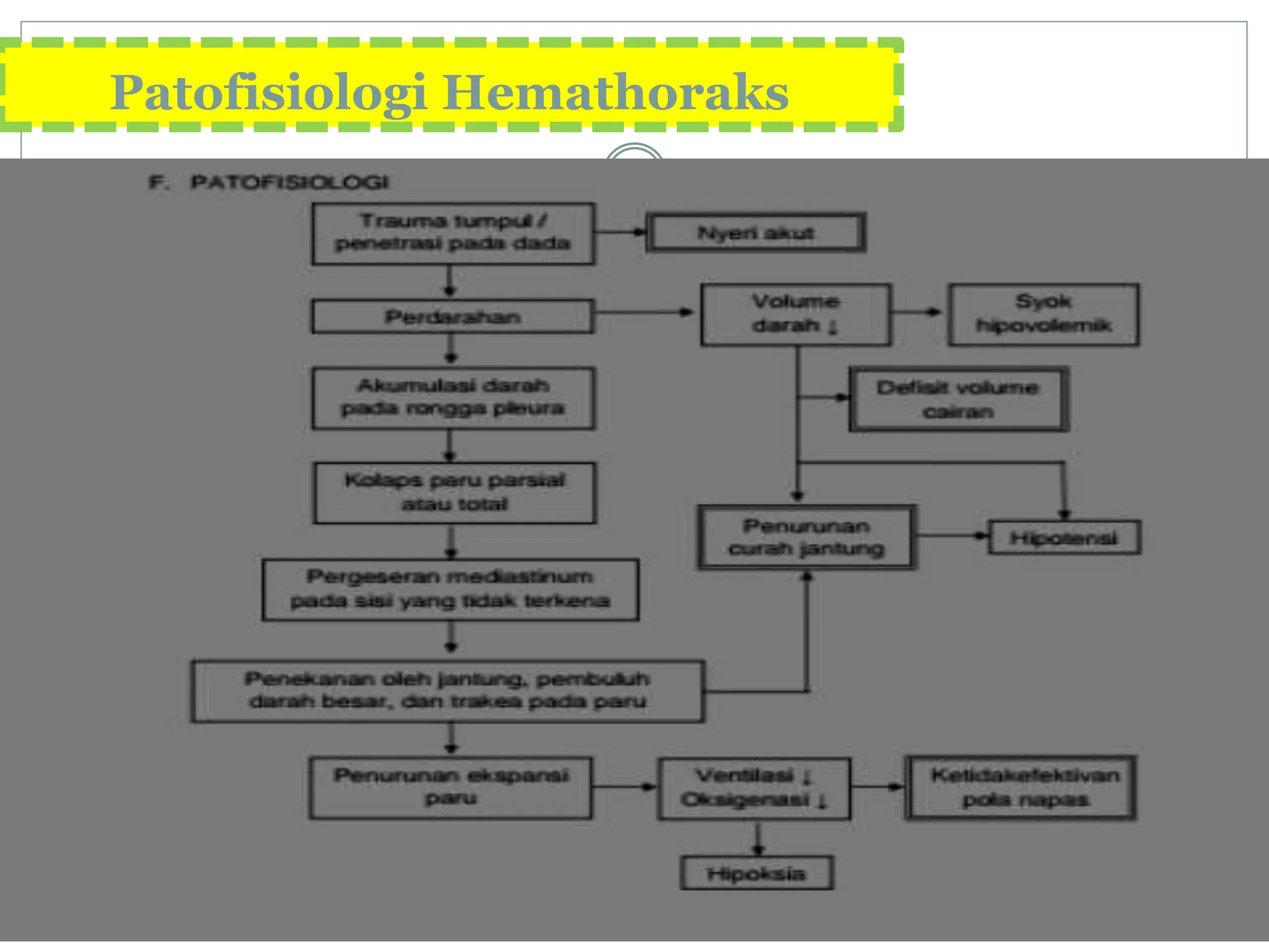 Hemathoraks Pptx