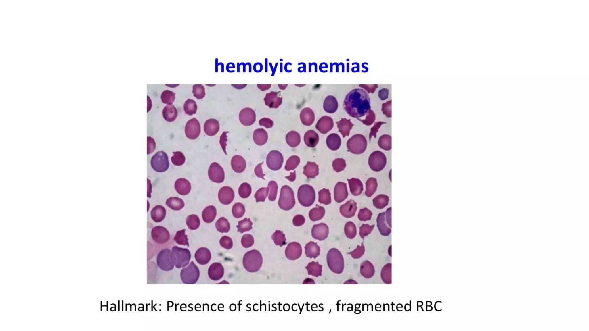Introduction to Hematology (Part - 2) | PPT