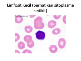Hematologi | PPT