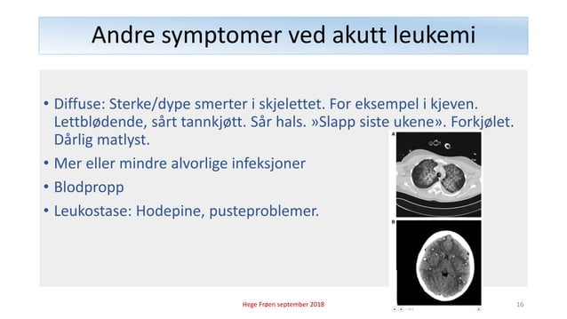 Hematologi - Hege Frøen | PPT