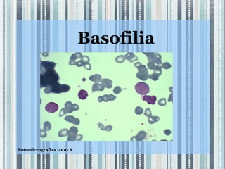 Hematologia clinica | PPT