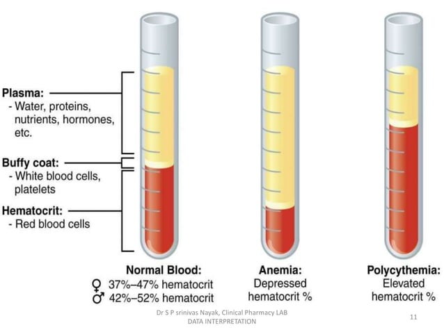 Hematological laboratory tests | PPTX | Blood Disorders | Diseases and ...