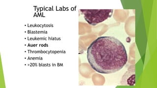 Hematological Malignancies-leukemias.pptx
