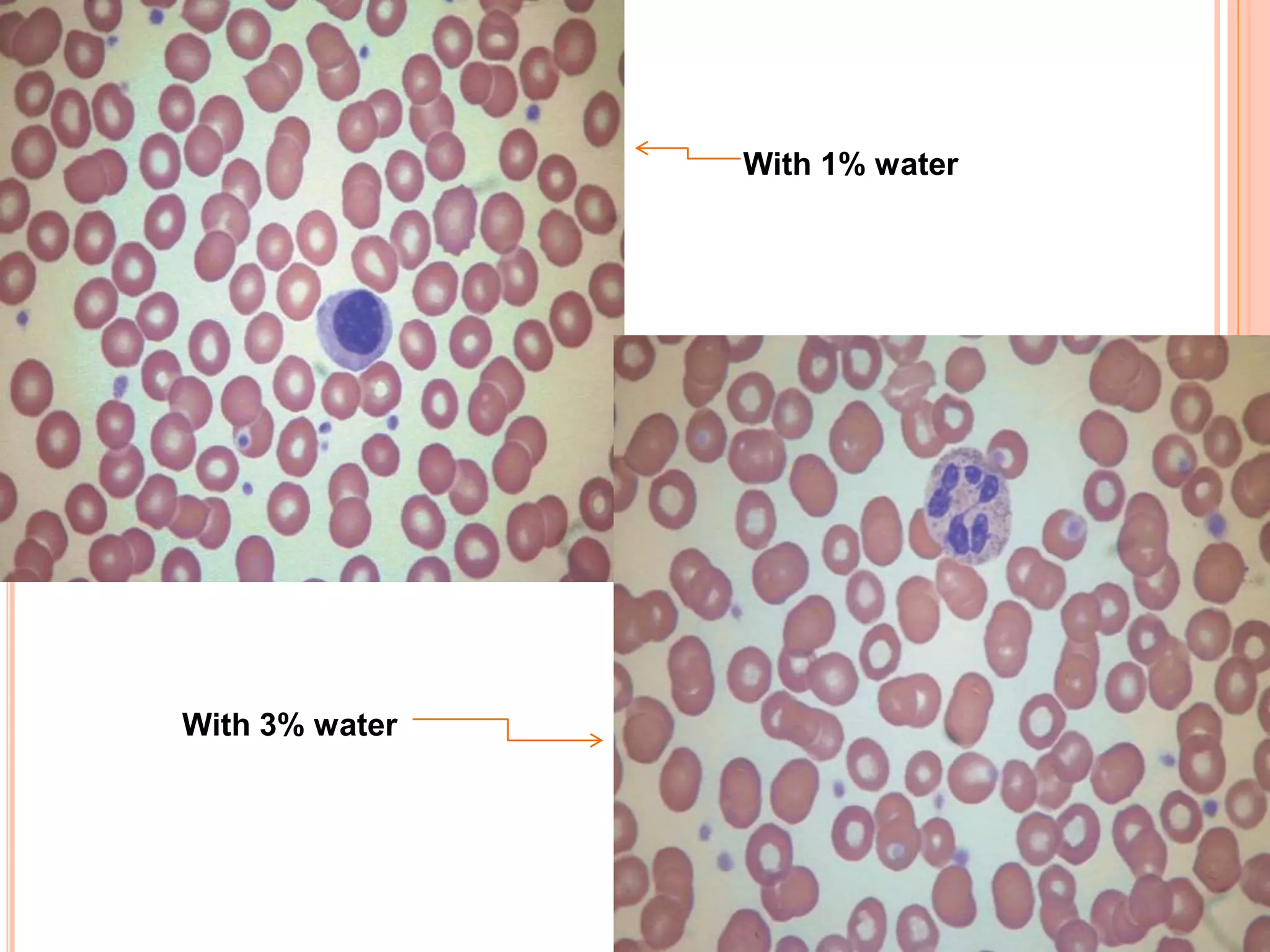 Hematological stains | PPTX