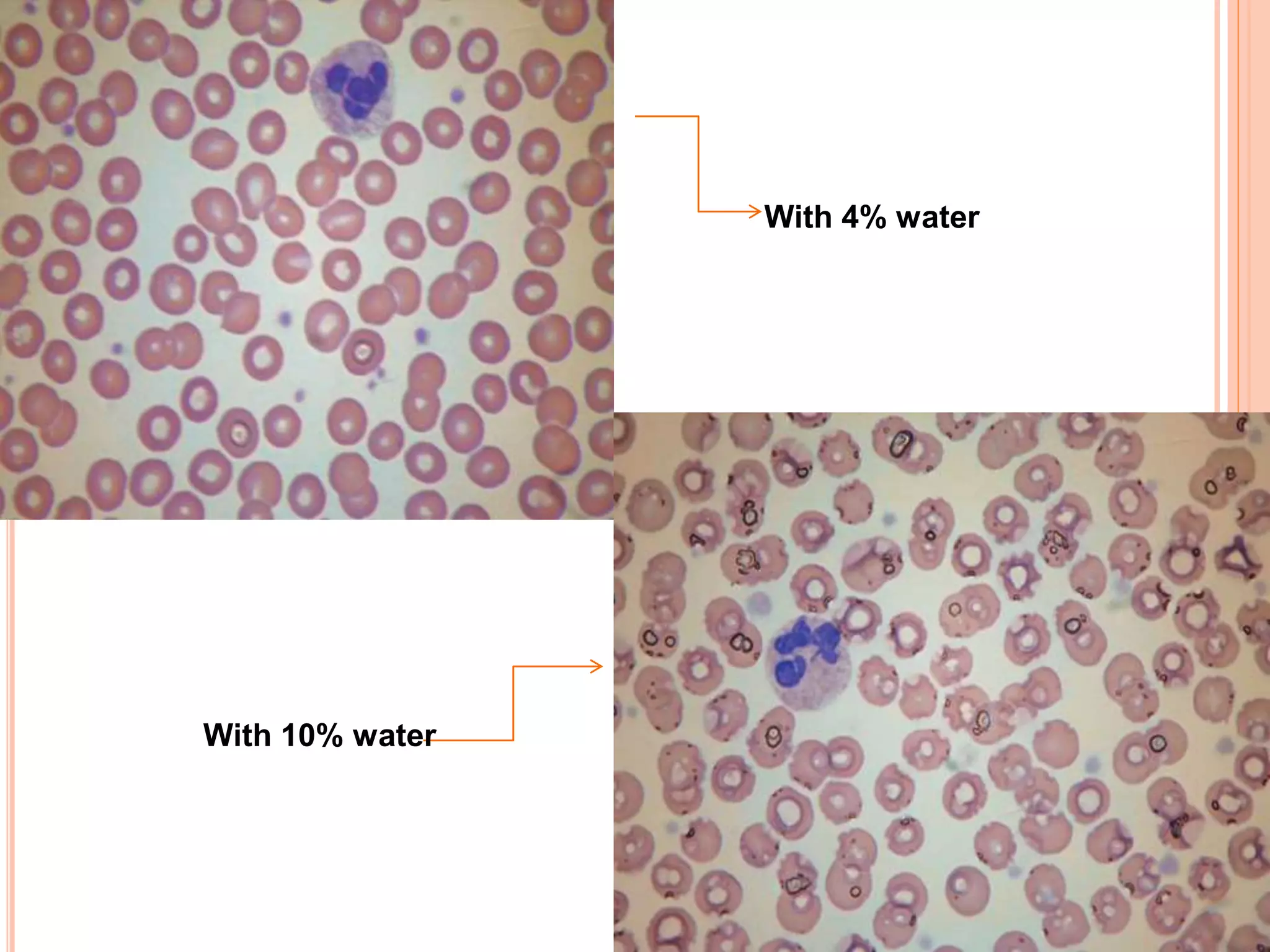 Hematological stains | PPTX