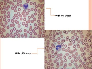 Hematological stains | PPTX