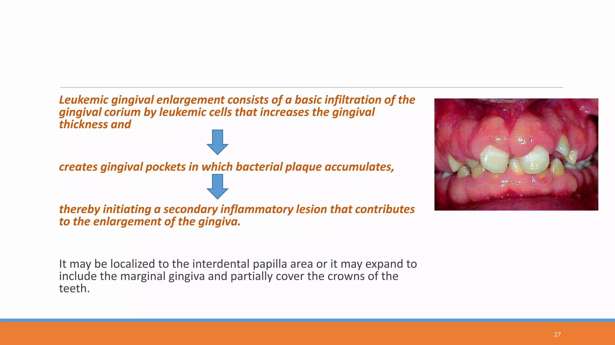 Hematologic disorders and Immune deficiencies | PPTX
