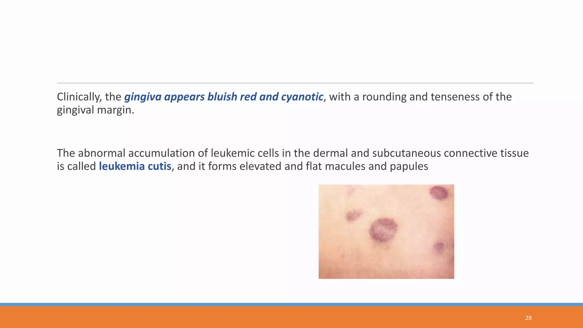 Hematologic disorders and Immune deficiencies | PPTX