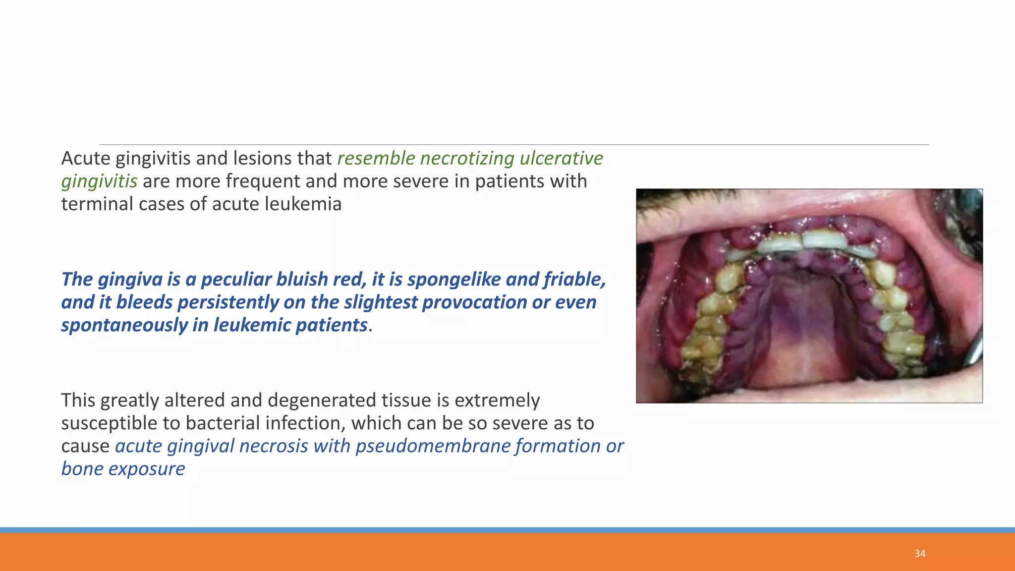 Hematologic disorders and Immune deficiencies | PPTX