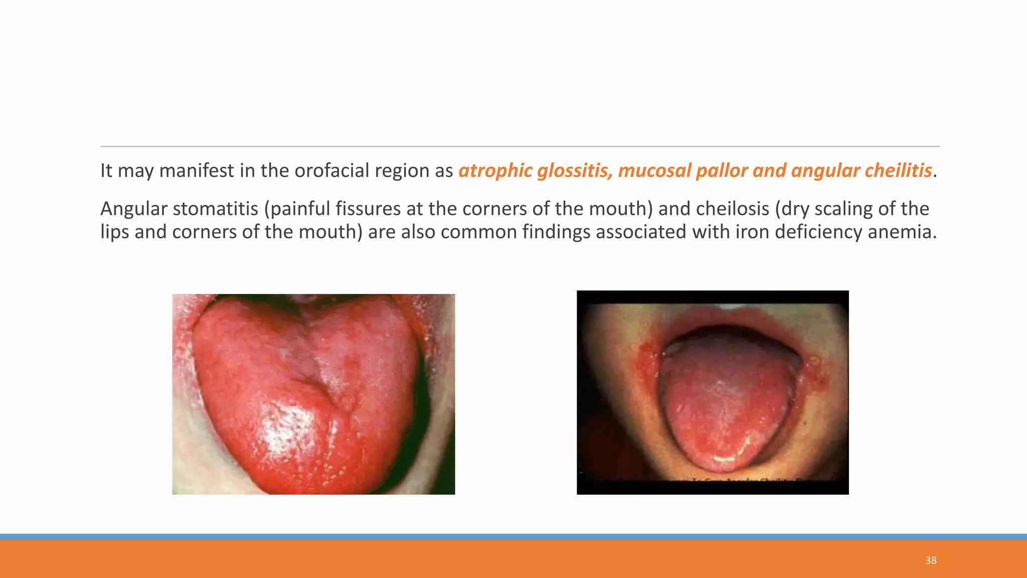 Hematologic disorders and Immune deficiencies | PPTX